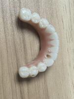 China Monolithic Zirconia Implant Bridge for Full Arch Restoration with CAD/CAM Precision for sale