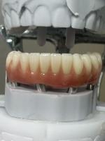 China Monolithic Zirconia Implant Bridge for Full Arch Restoration with CAD/CAM Precision for sale
