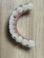 China Monolithic Zirconia Implant Bridge for Full Arch Restoration with CAD/CAM Precision for sale