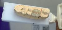 China Full Zirconia Crown with 1200 MPa Strength, High Aesthetic Translucency, and CAD/CAM Precision Milling for Dental Restoration for sale