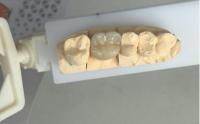 China Full Zirconia Crown with 1200 MPa Strength, High Aesthetic Translucency, and CAD/CAM Precision Milling for Dental Restoration for sale