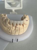 China Full Zirconia High Strength Biocompatible Material for Dental Applications for sale