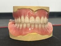 China Custom Full Denture with Natural Appearance and Comfortable Fit for Complete Arch Restoration for sale