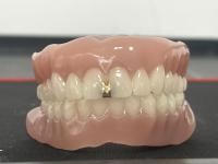 China Custom Full Denture with Natural Appearance and Comfortable Fit for Complete Arch Restoration for sale
