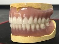 China Custom Full Denture with Natural Appearance and Comfortable Fit for Complete Arch Restoration for sale