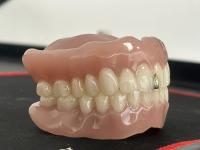 China Custom Full Denture with Natural Appearance and Comfortable Fit for Complete Arch Restoration for sale