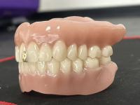 China Custom Full Denture with Natural Appearance and Comfortable Fit for Complete Arch Restoration for sale