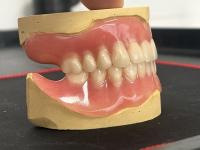 China Custom Full Denture with Natural Appearance and Comfortable Fit for Complete Arch Restoration for sale