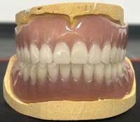 China Custom Full Denture with Natural Appearance and Comfortable Fit for Complete Arch Restoration for sale