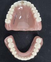 China Custom Full Denture with Natural Appearance and Comfortable Fit for Complete Arch Restoration for sale