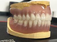 China Custom Full Denture with Natural Appearance and Comfortable Fit for Complete Arch Restoration for sale