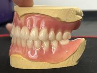 China Custom Full Denture with Natural Appearance and Comfortable Fit for Complete Arch Restoration for sale