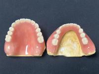 China Custom Full Denture with Natural Appearance and Comfortable Fit for Complete Arch Restoration for sale