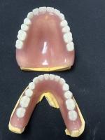 China Custom Full Denture with Natural Appearance and Comfortable Fit for Complete Arch Restoration for sale