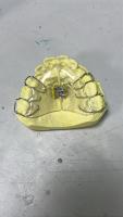 China Customized Orthodontic Appliances and Dental Aligners with Digital Design and Medical-Grade Thermoplastic for sale