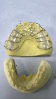 China Customized Orthodontic Appliances and Dental Aligners with Digital Design and Medical-Grade Thermoplastic for sale
