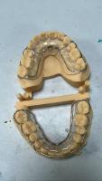China Customized Orthodontic Appliances and Dental Aligners with Digital Design and Medical-Grade Thermoplastic for sale