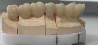 China Full Zirconia Bridge with 1200 MPa Strength High Translucency and Metal-Free for Superior Dental Restorations for sale