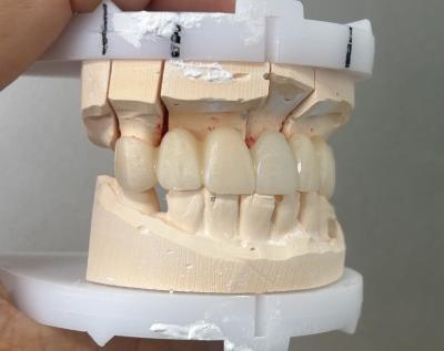 China Full Zirconia Bridge with 1200 MPa Strength High Translucency and Metal-Free for Superior Dental Restorations for sale