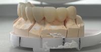 China Full Zirconia Bridge with 1200 MPa Strength High Translucency and Metal-Free for Superior Dental Restorations for sale