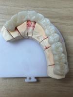 China Full Zirconia Bridge with 1200 MPa Strength High Translucency and Metal-Free for Superior Dental Restorations for sale