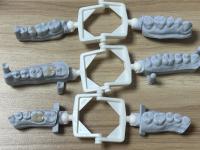 China Dental Inlay Tooth Restoration with CAD/CAM Digital Technology High Fracture Resistance and Metal-Free for sale