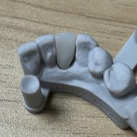 China Premium Monolithic Zirconia Crown with High Flexural Strength and CAD/CAM Digital Technology for Dental Restoration for sale
