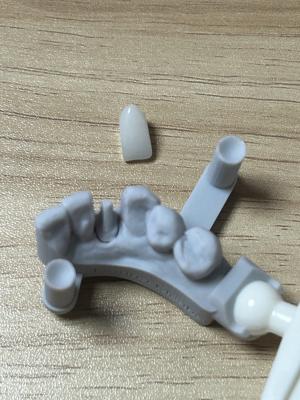 China Premium Monolithic Zirconia Crown with High Flexural Strength and CAD/CAM Digital Technology for Dental Restoration for sale