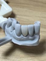 China Premium Monolithic Zirconia Crown with High Flexural Strength and CAD/CAM Digital Technology for Dental Restoration for sale
