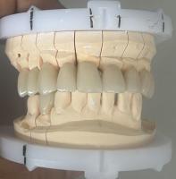 China High Translucency Full Zirconia Crown with ≥1200 MPa Strength and CAD/CAM Digital Milling for sale
