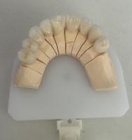 China High Translucency Full Zirconia Crown with ≥1200 MPa Strength and CAD/CAM Digital Milling for sale