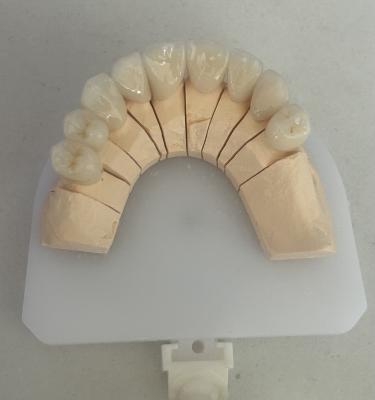 China High Translucency Full Zirconia Crown with ≥1200 MPa Strength and CAD/CAM Digital Milling for sale