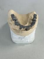 China High Strength Cobalt Chrome Implant Denture with Corrosion Resistance and Biocompatible Co-Cr Alloy for sale