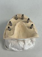 China High Strength Cobalt Chrome Implant Denture with Corrosion Resistance and Biocompatible Co-Cr Alloy for sale
