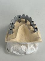 China High Strength Cobalt Chrome Implant Denture with Corrosion Resistance and Biocompatible Co-Cr Alloy for sale