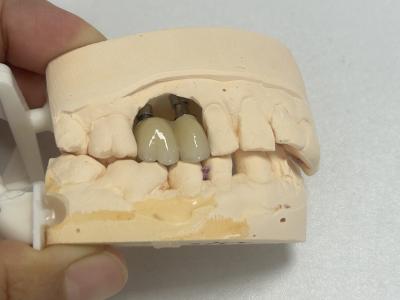 China China Dental Implant with Stable Fixation and Natural Appearance for Tooth Restoration for sale
