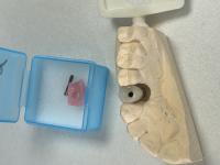 China China Dental Implant with Stable Fixation and Natural Appearance for Tooth Restoration for sale