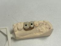China China Dental Implant with Stable Fixation and Natural Appearance for Tooth Restoration for sale