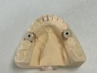 China China Dental Implant with Stable Fixation and Natural Appearance for Tooth Restoration for sale