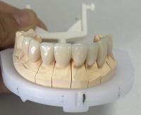 China High Strength Full Zirconia Teeth with Natural Aesthetic from ShenZhen Dental Lab for sale