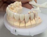 China High Strength Full Zirconia Teeth with Natural Aesthetic from ShenZhen Dental Lab for sale