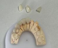 China High Strength Full Zirconia Teeth with Natural Aesthetic from ShenZhen Dental Lab for sale