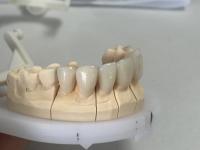China High Strength Full Zirconia Teeth with Natural Aesthetic from ShenZhen Dental Lab for sale