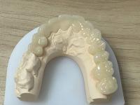 China Custom CAD/CAM Digital Design Temporary Teeth with Natural Appearance and Comfortable Fit for Dental Restoration for sale