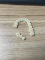 China Custom CAD/CAM Digital Design Temporary Teeth with Natural Appearance and Comfortable Fit for Dental Restoration for sale