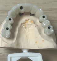 China High-Strength Dental Zirconia Implant Crown with Natural Translucency & Tooth-Like Appearance via Digital CAD/CAM for sale
