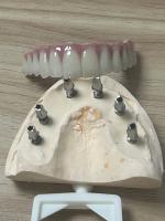 China High-Strength Dental Zirconia Implant Crown with Natural Translucency & Tooth-Like Appearance via Digital CAD/CAM for sale