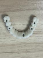 China High-Strength Dental Zirconia Implant Crown with Natural Translucency & Tooth-Like Appearance via Digital CAD/CAM for sale