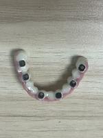 China High-Strength Dental Zirconia Implant Crown with Natural Translucency & Tooth-Like Appearance via Digital CAD/CAM for sale