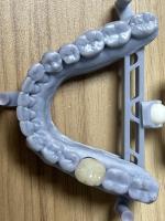 China High Strength Metal-Free Full Zirconia Dental Crown for sale